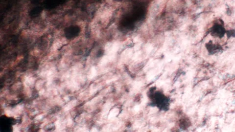 capillaries and erythrocytes at microsco... | Stock Video | Pond5