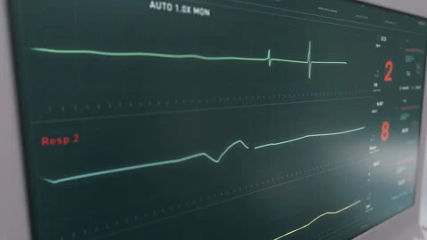 Cardiac Monitoring Hospital Device Displ... | Stock Video | Pond5