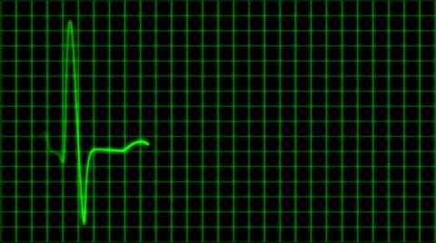 Cardiograph Stock Footage ~ Royalty Free Stock Videos | Pond5