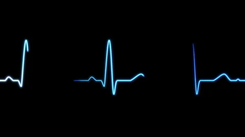 Cardiogram EKG ECG signal. Heart beat wa... | Stock Video | Pond5