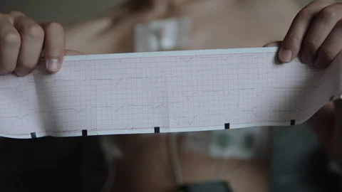 Ecg Graph Paper Stock Video Footage | Royalty Free Ecg Graph Paper ...