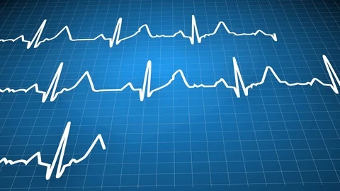 Cardiogram waves on a blue background | Stock Video | Pond5