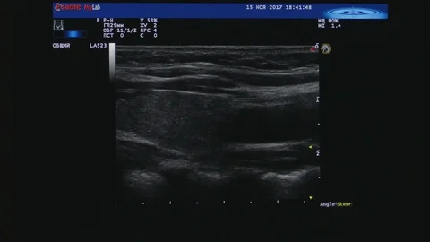 Ultrasound F Stock Videos – Royalty-Free HD & 4K Videos | Page 2