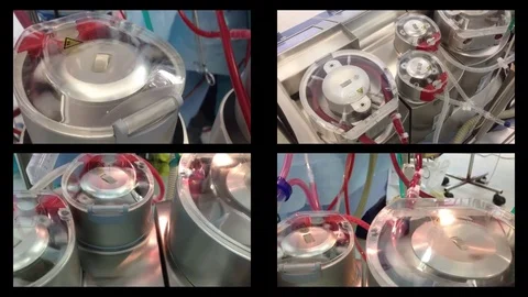 Cardiopulmonary Bypass Stock Footage ~ Royalty Free Stock Videos | Pond5