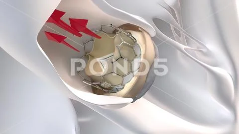 The Cardiovascular System. 3D Medical 3D illustration of the Aortic ...