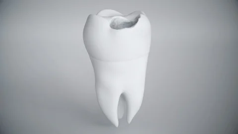 Caries in different stages as an animati... | Stock Video | Pond5