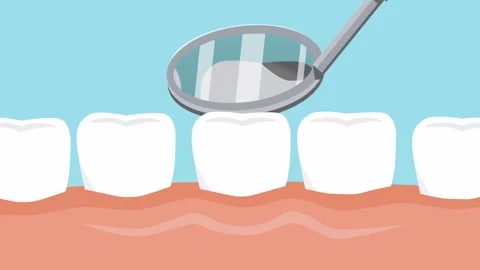 Cartoon healthy teeth inspection with mi... | Stock Video | Pond5