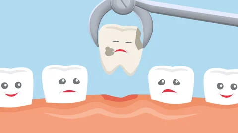 Cartoon tooth extraction dental animatio... | Stock Video | Pond5