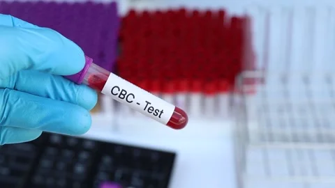 CBC test to look for abnormalities from ... | Stock Video | Pond5