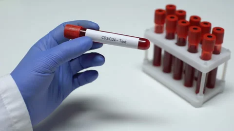 CD3 CD4 test, doctor showing blood sampl... | Stock Video | Pond5