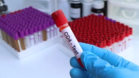CD4 test to look for abnormalities from ... | Stock Video | Pond5