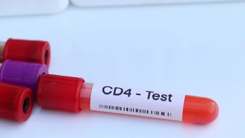 CD4 test to look for abnormalities from ... | Stock Video | Pond5
