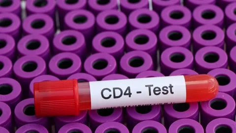 CD4 test to look for abnormalities from ... | Stock Video | Pond5