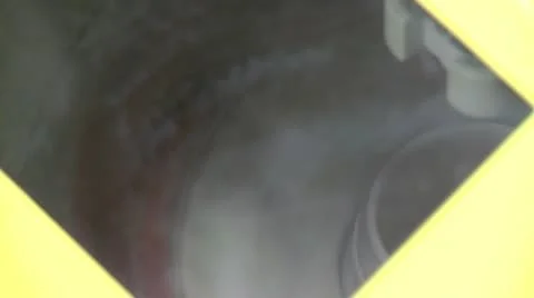 Cell Saver Stock Video Footage | Royalty Free Cell Saver Videos | Pond5