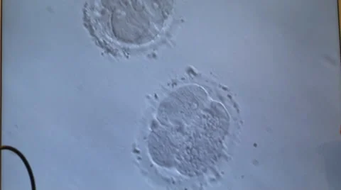 Cellular division of an in vitro fetus u... | Stock Video | Pond5