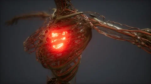 CG Animation Of A Sick Human Heart | Stock Video | Pond5