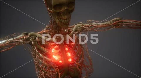 CG Animation Of A Sick Human Heart CG Animation Of A Sick Human Heart ...