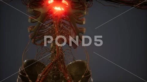 CG Animation Of A Sick Human Heart CG Animation Of A Sick Human Heart ...