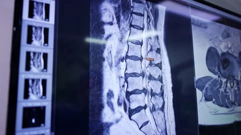 Checking Spine Stock Videos – Royalty-Free HD & 4K Videos
