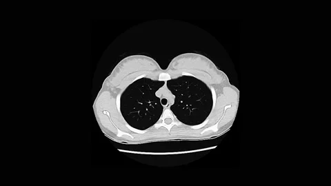 Chest CT Scan ( Thorax Computed Tomograp... | Stock Video | Pond5