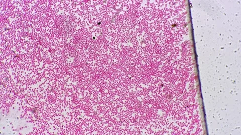 Chicken blood smear under microscope 100... | Stock Video | Pond5