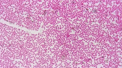 Chicken blood smear under microscope 400... | Stock Video | Pond5