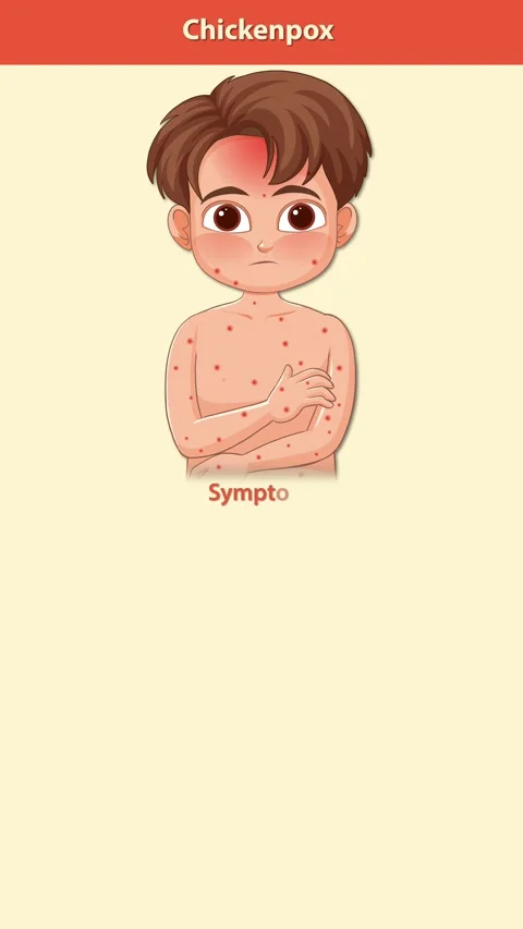 Chickenpox Symptoms Progression in Young... | Stock Video | Pond5