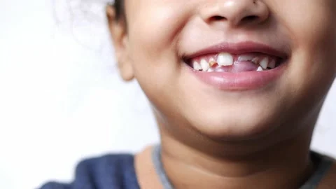 child girl with deformed teeth | Stock Video | Pond5