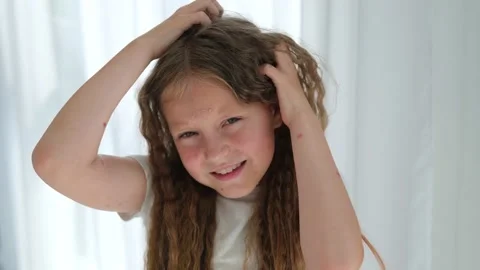 The child scratches his head with a rash... | Stock Video | Pond5