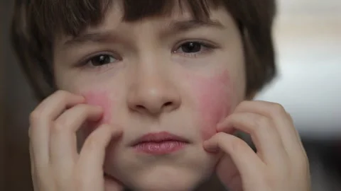 Scratching Skin Stock Footage ~ Royalty Free Stock Videos | Pond5