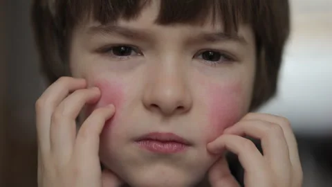 Scratching Skin Stock Footage ~ Royalty Free Stock Videos | Pond5