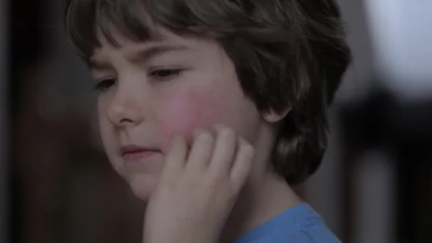 Scratching Skin Stock Footage ~ Royalty Free Stock Videos | Pond5