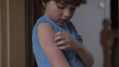 Scratching Skin Stock Footage ~ Royalty Free Stock Videos | Pond5