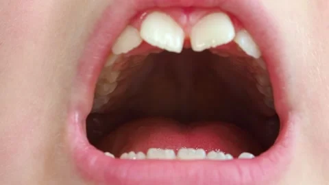 Children's open mouth large. Taste buds ... | Stock Video | Pond5