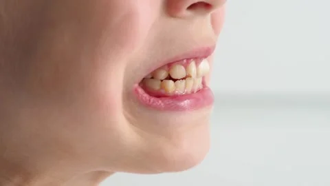 Children's teeth are large. Wide open mo... | Stock Video | Pond5