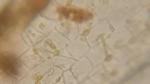 Plant Cell Microscope Stock Video Footage | Royalty Free Plant Cell ...