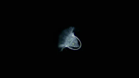 Ciliophora Cyttarocylis sp. under the mi... | Stock Video | Pond5