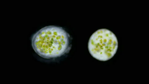 Ciliophora under a microscope, class Cil... | Stock Video | Pond5