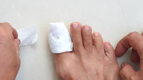Wound Feet Stock Video Footage | Royalty Free Wound Feet Videos | Pond5