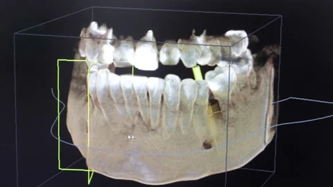 Close-up 3d model of X-ray images of the... | Stock Video | Pond5
