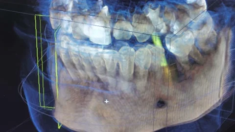 Close-up 3d model of X-ray images of the... | Stock Video | Pond5