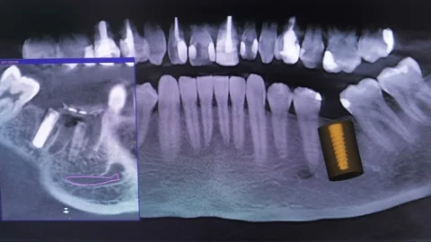 Close-up 3d model of X-ray images of the... | Stock Video | Pond5