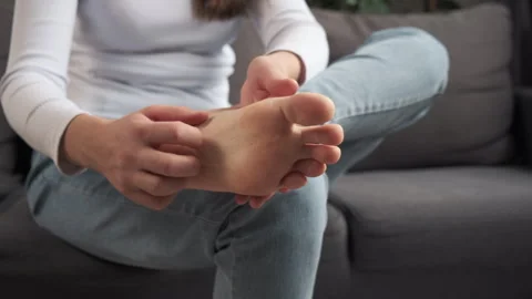 Close up ache woman hand scratch feet, i... | Stock Video | Pond5