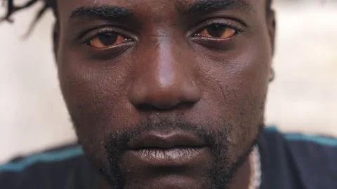 Close up of angry sad african young man ... | Stock Video | Pond5