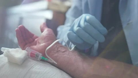 Close up of blood donation on hand and a... | Stock Video | Pond5