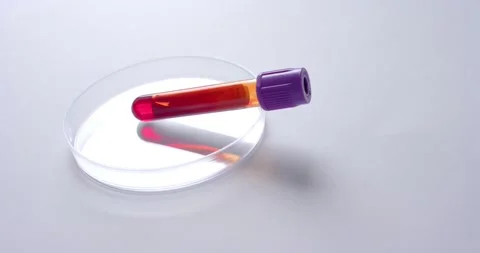 Close up of blood sample and petri dish ... | Stock Video | Pond5
