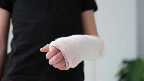 Close-up of a broken arm of a child in a... | Stock Video | Pond5