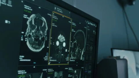 Digital Brain Image Stock Videos – Royalty-Free HD & 4K Videos