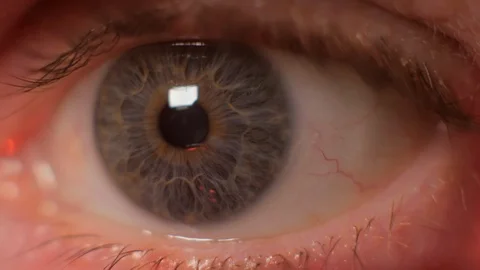 Eye Flashing Stock Video Footage | Royalty Free Eye Flashing Videos | Pond5