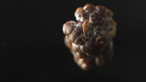 Close-up of a kidney stone. Neoplasm uro... | Stock Video | Pond5